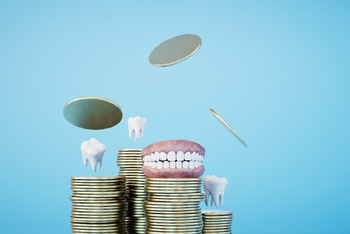 All 4 Dental Implants Cost | Dental Blog - Northern Beaches Dental